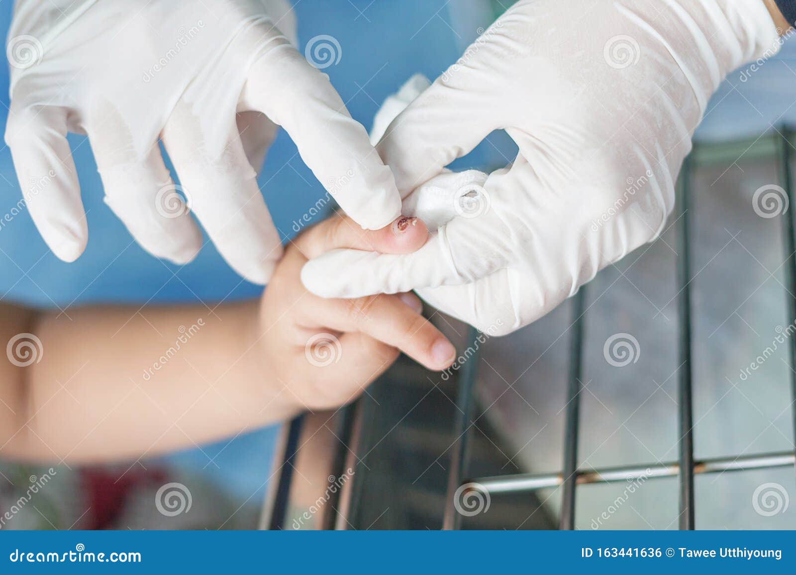 Cutting finger wound stock photo. Image of treatment - 163441636