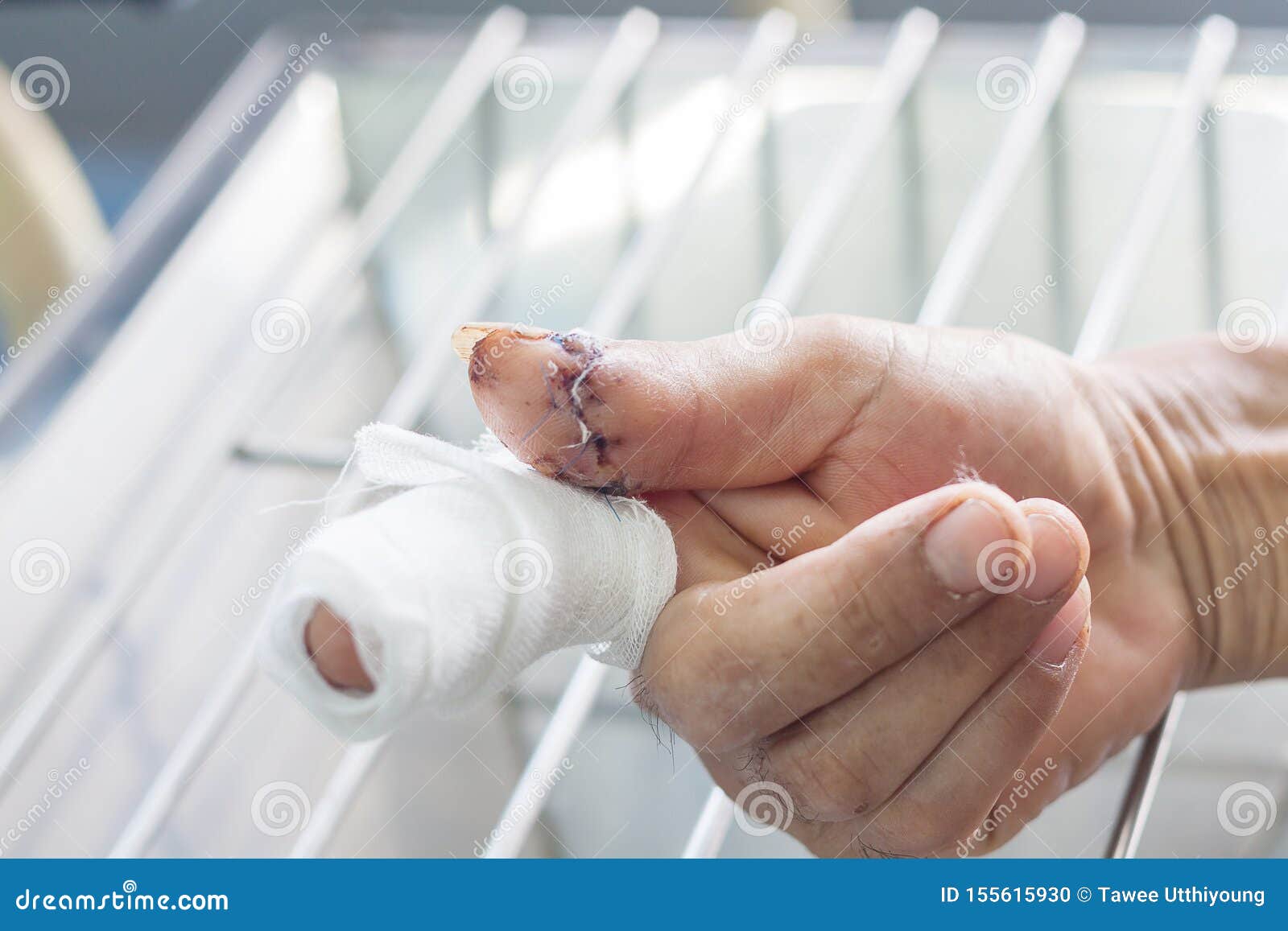 Cutting finger wound stock photo. Image of emergency - 155615930