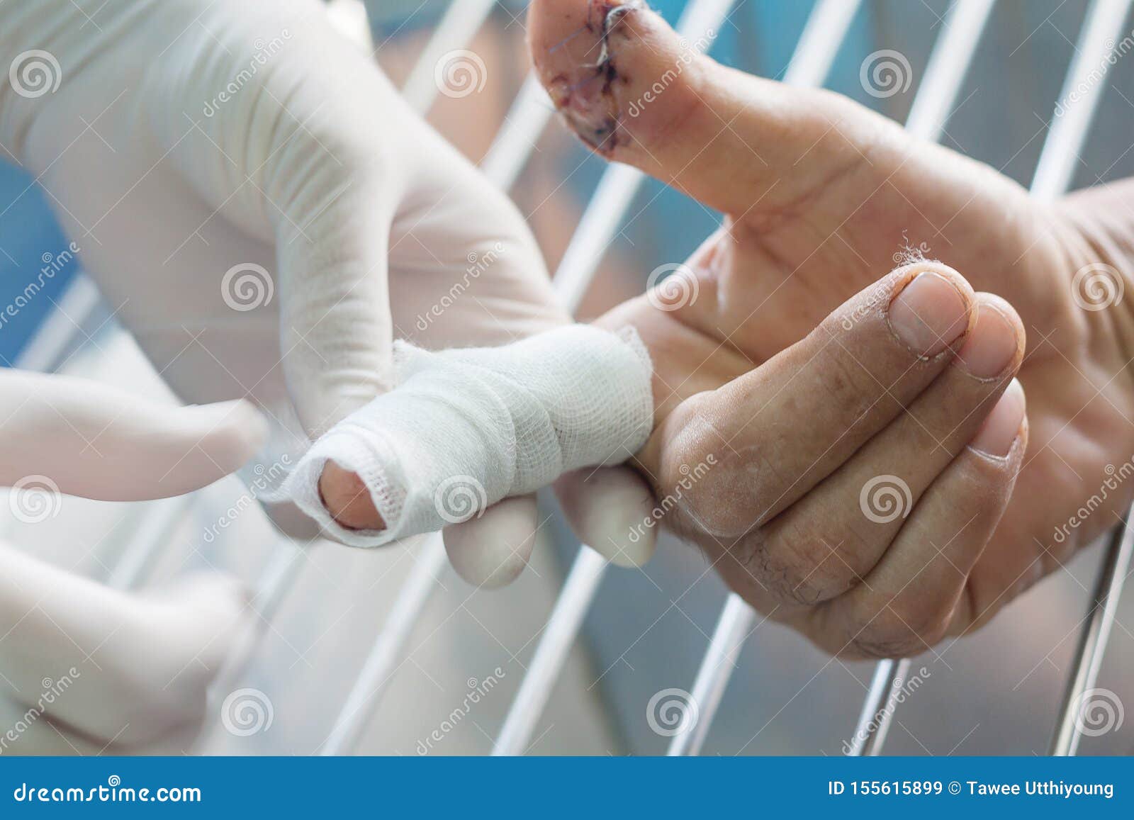 Cutting finger wound stock image. Image of cure, operation - 155615899