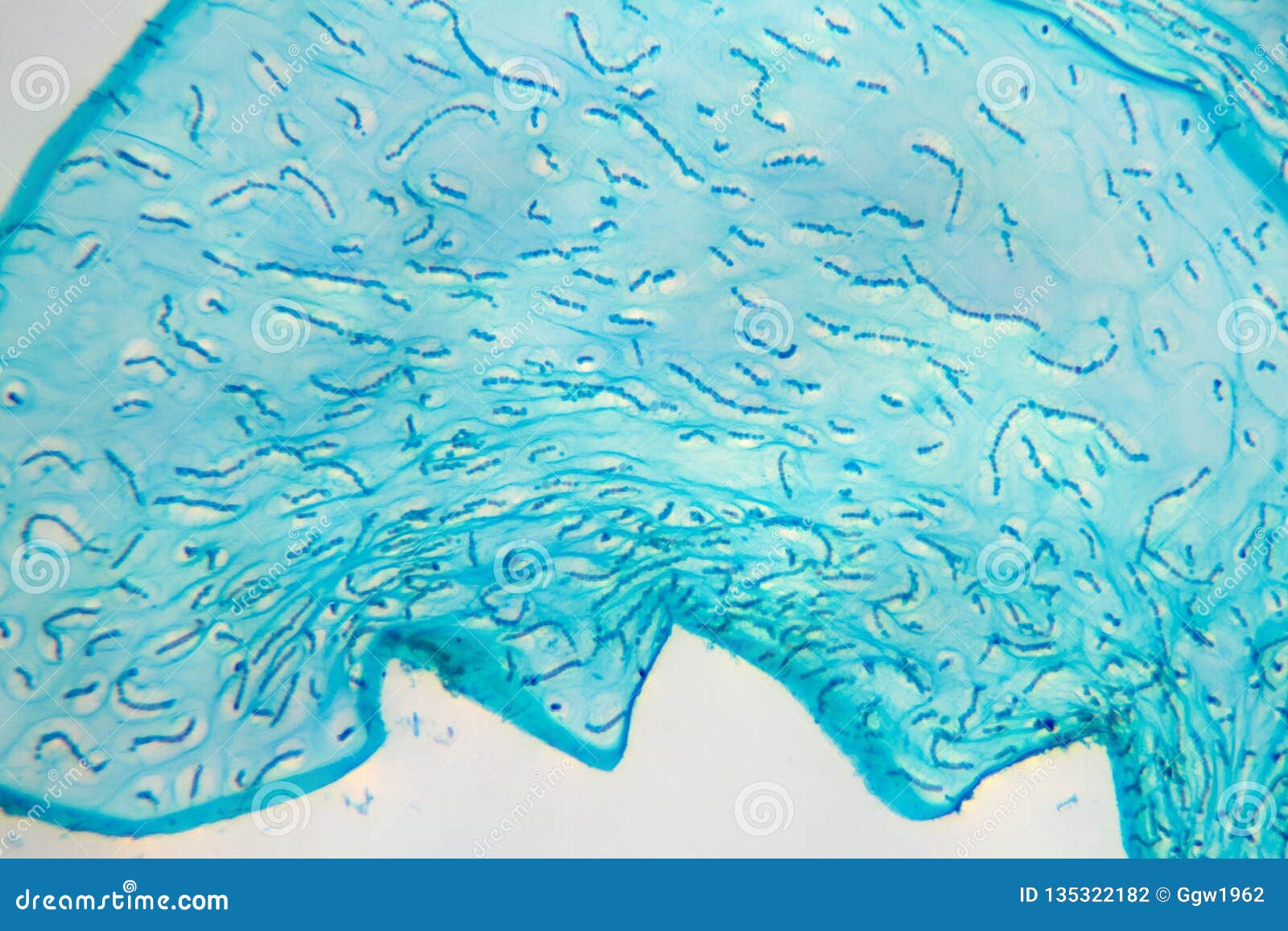 Cyanobacteria Nostoc stock photo. Image of cells, microscope - 135322182