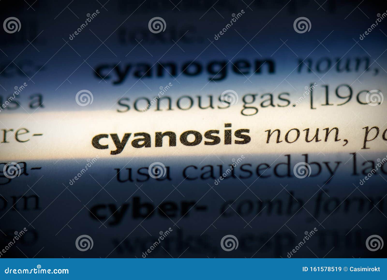 Cyanosis stock image. Image of info, concept, thesaurus - 161578519