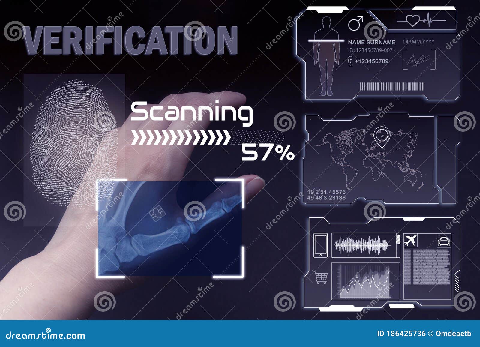 Cyber Security Network. Arm with Digital Implants and Microchips Under ...