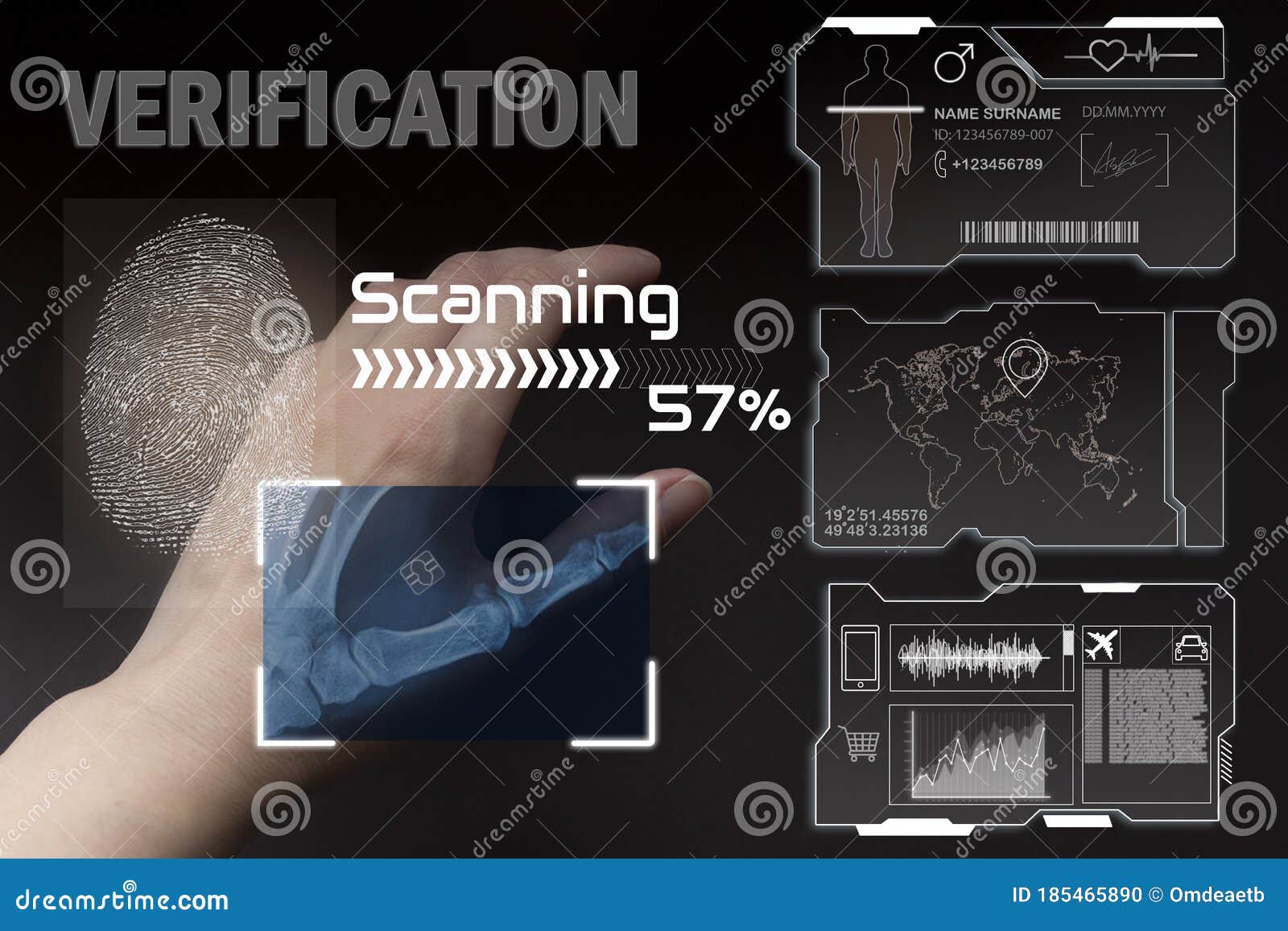 Cyber Security Network. Arm with Digital Implants and Microchips Under ...
