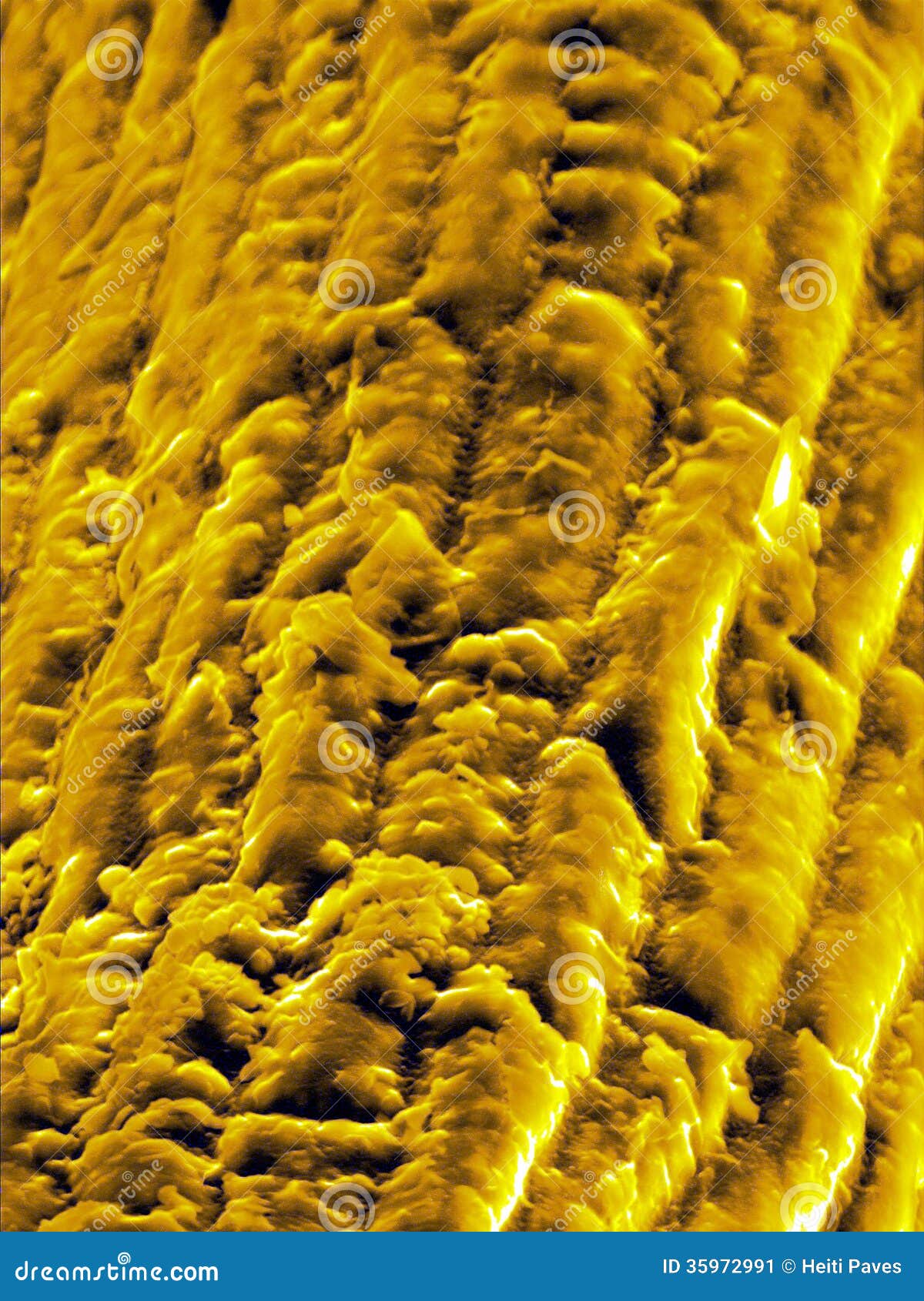 The Leaf Epidermis Under Light Microscope View Has Small Pores, Called ...