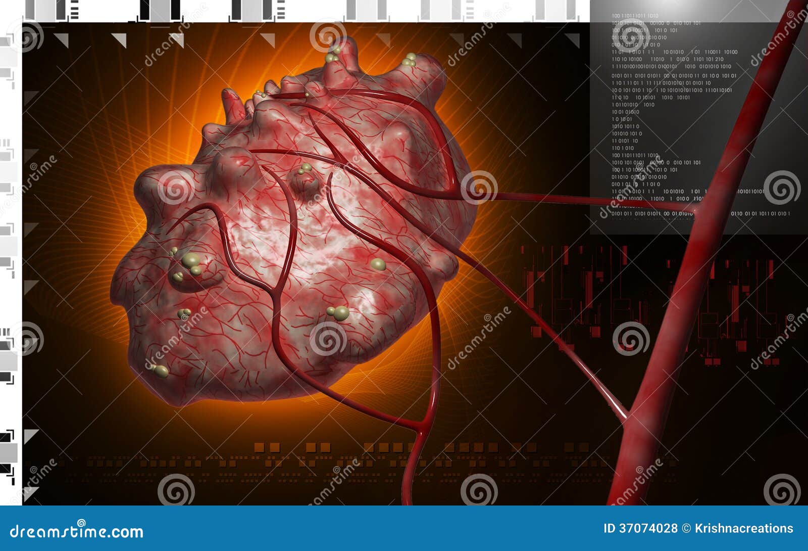 Cyst Cartoons, Illustrations & Vector Stock Images - 2010 Pictures to ...