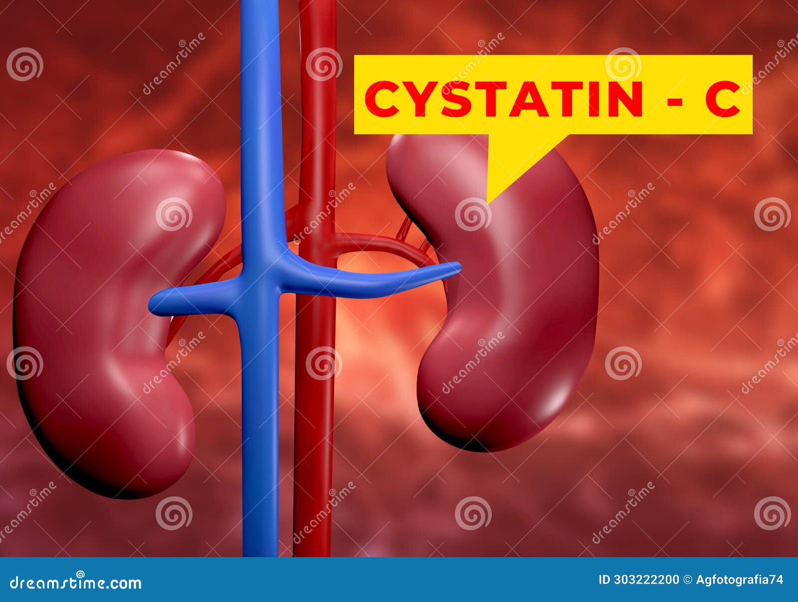 Cystatin C is a Protein Mainly Used As a Biomarker of Kidney Function ...