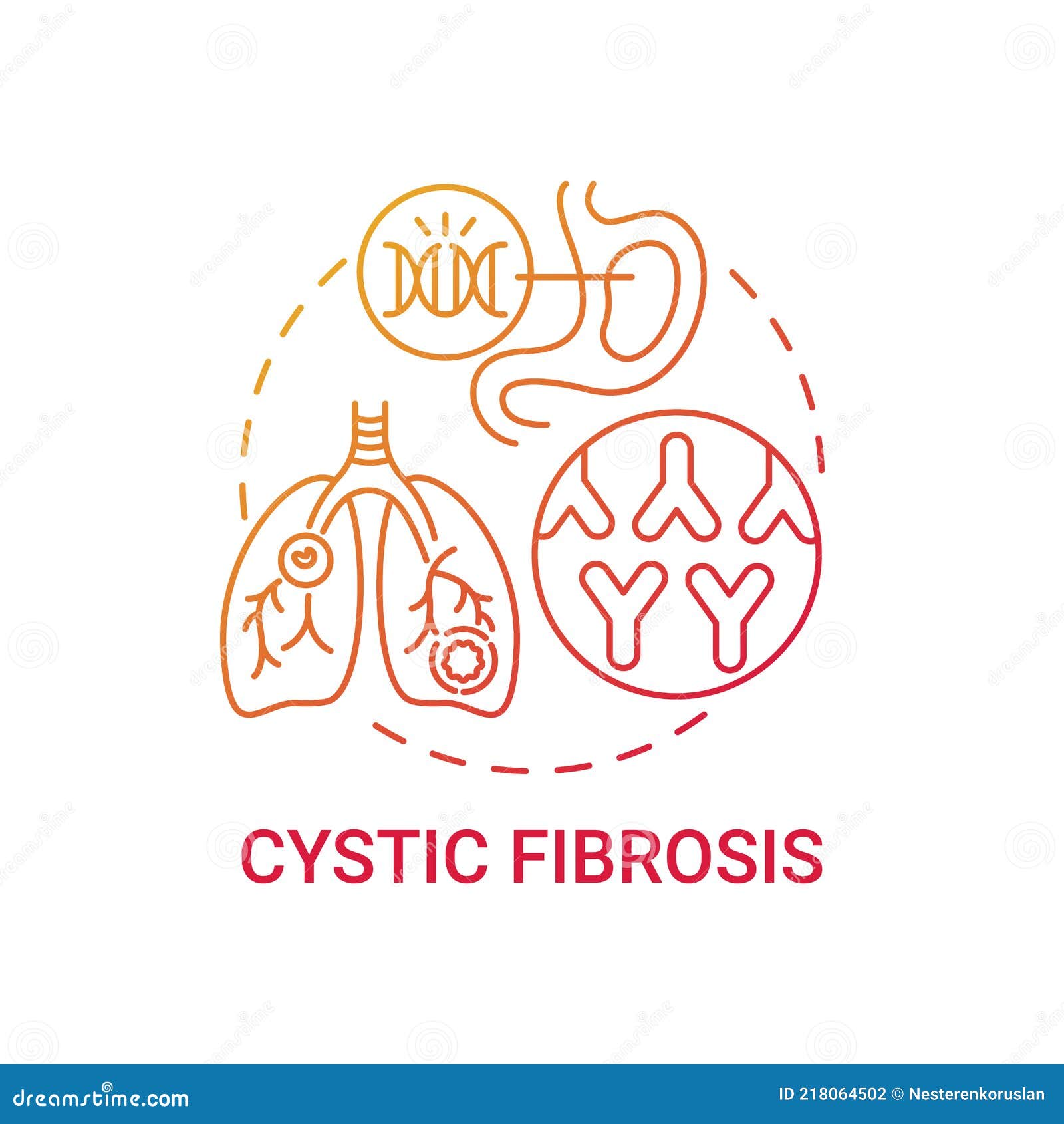 Cystic Fibrosis Red Gradient Concept Icon Stock Vector - Illustration ...