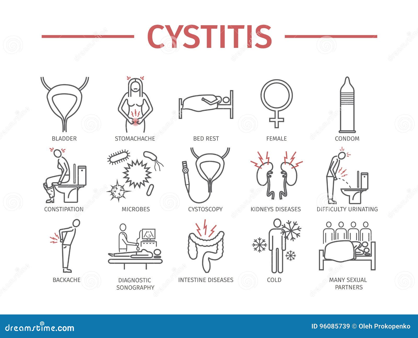 Cystite Symptômes, Traitement Illustration Stock - Illustration du ...