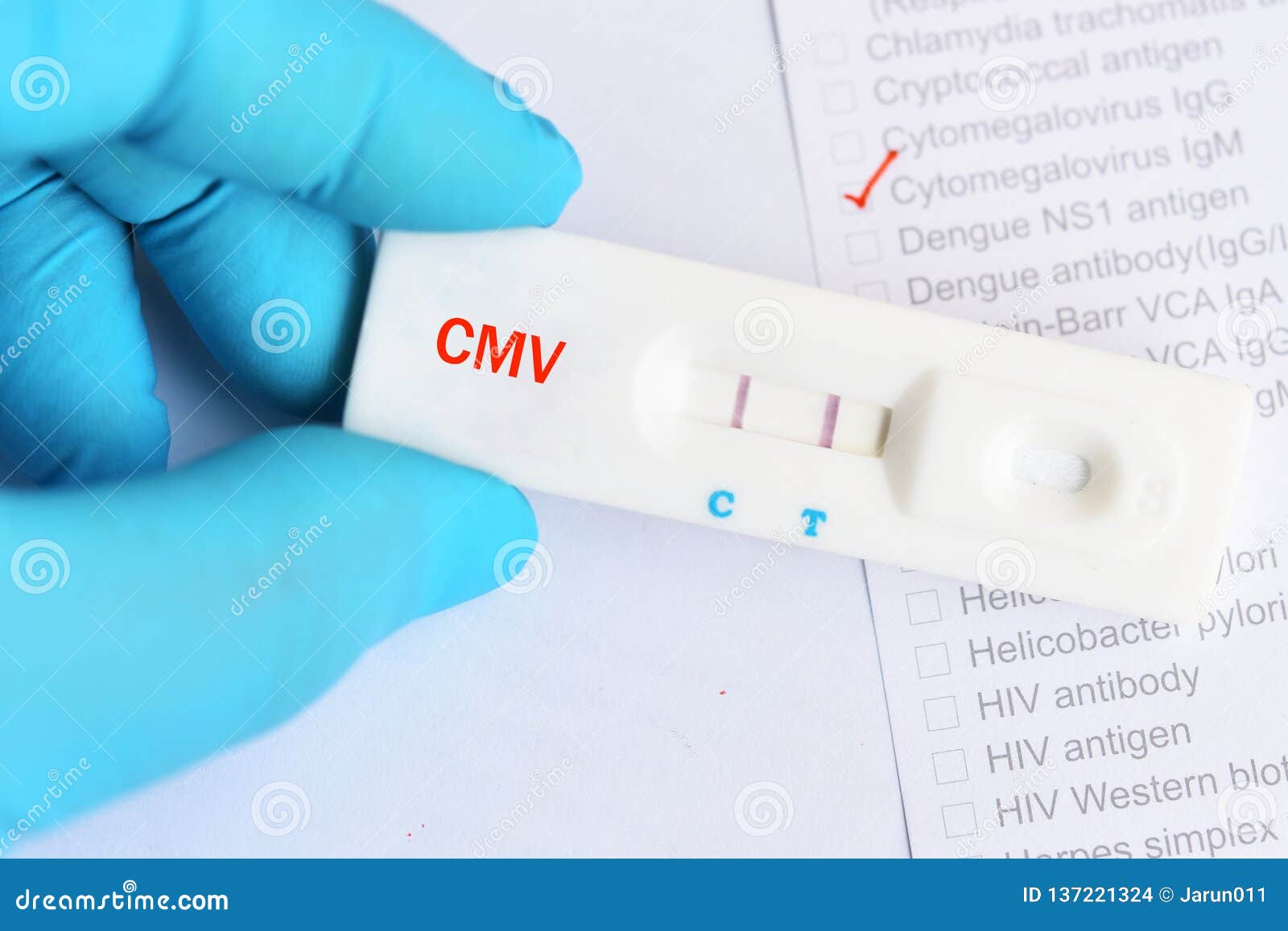 Cytomegalovirus Positive Test Result Stock Photo - Image of herpes ...