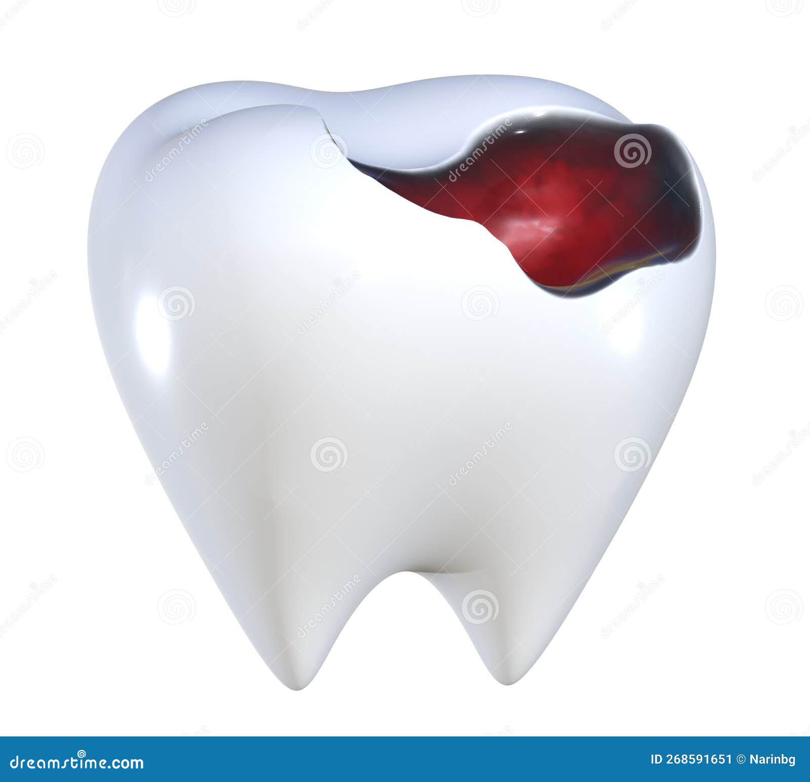 Teeth Decay 3D Icon Illustration Stock Image - Illustration of isolated ...