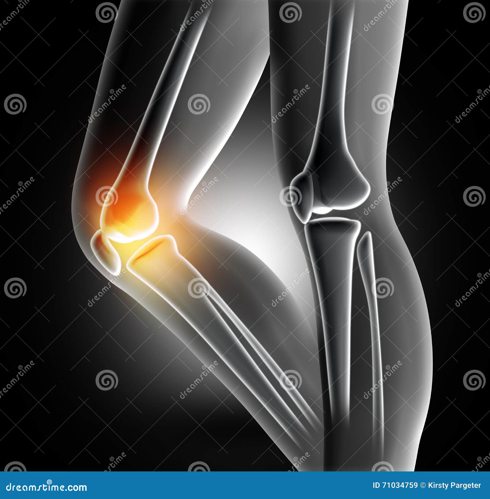 3D Female Medical Image of Bones in Knee Stock Illustration ...