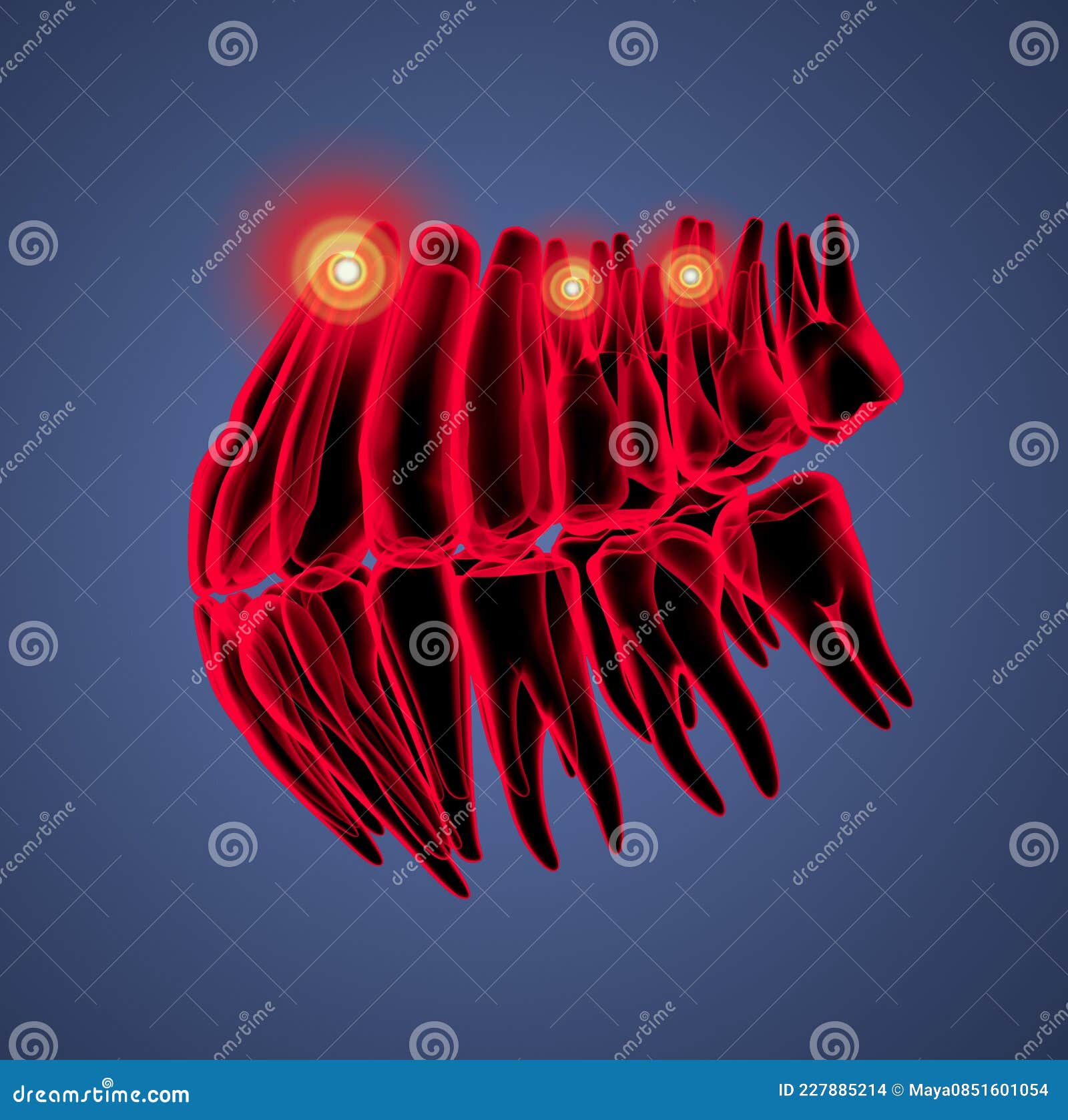 3D Rendering Illustration of Teeth Stock Illustration - Illustration of ...