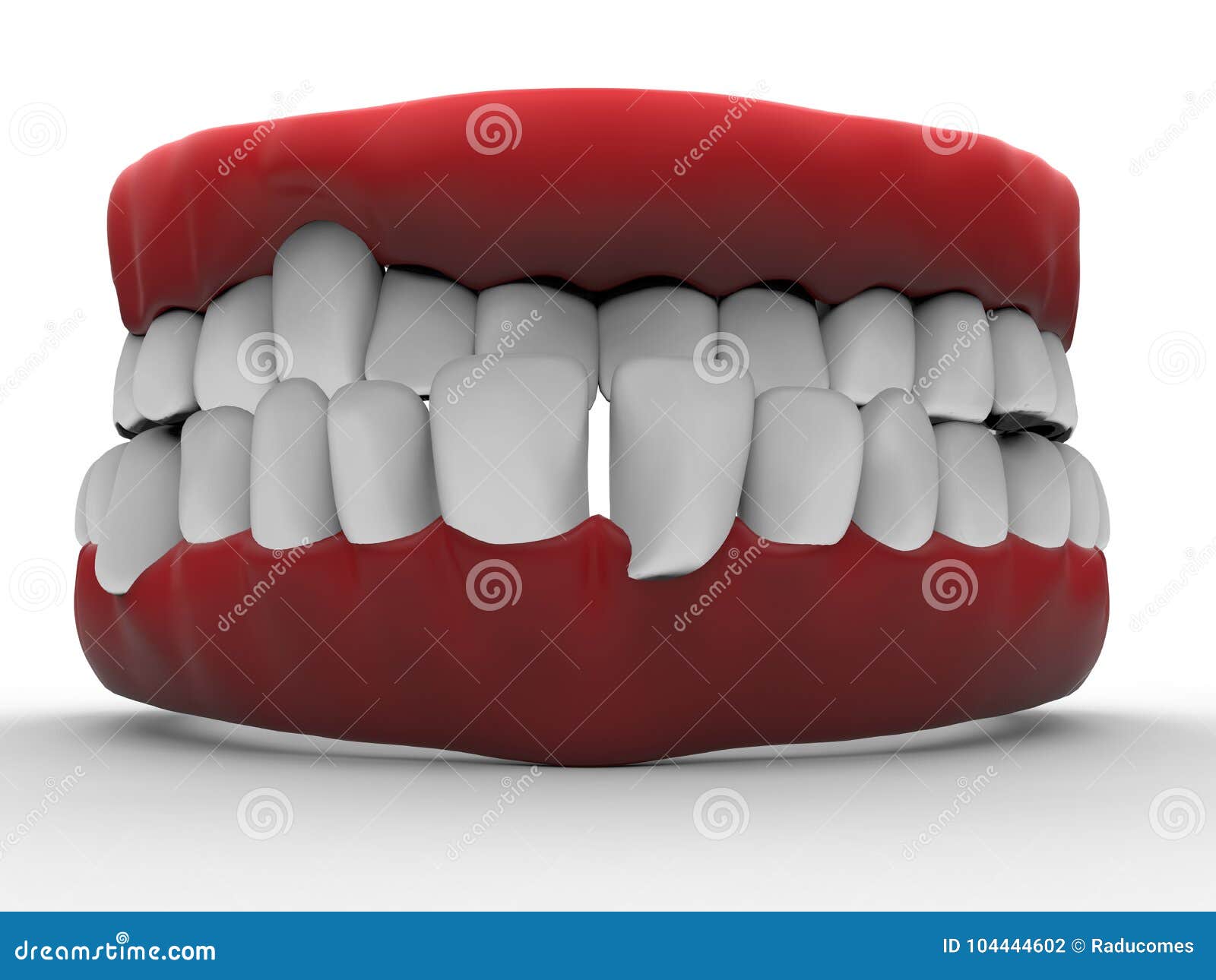 3D Illustration - Bad Teeth Stock Illustration - Illustration of render ...