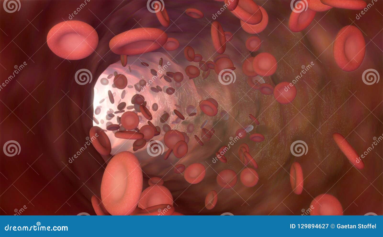 3D Illustration of a Bloodstream with Red Cell White Cell and Platelet ...
