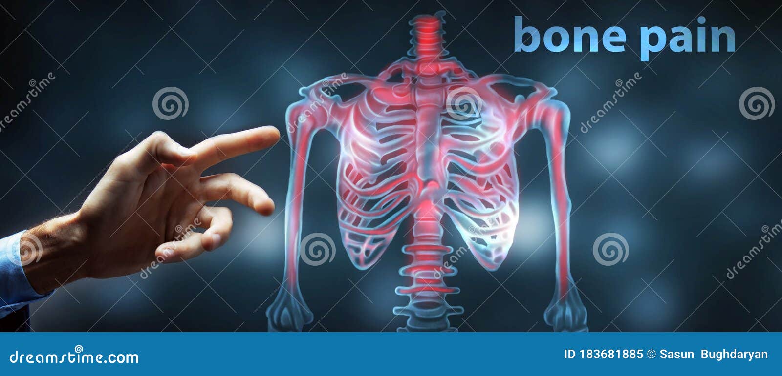 3d Illustration of Bone Pain, Examining Stock Image - Image of ...