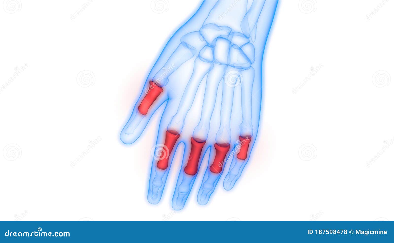 Human Skeleton System Distal Phalanges Joints Anatomy Stock Photo ...