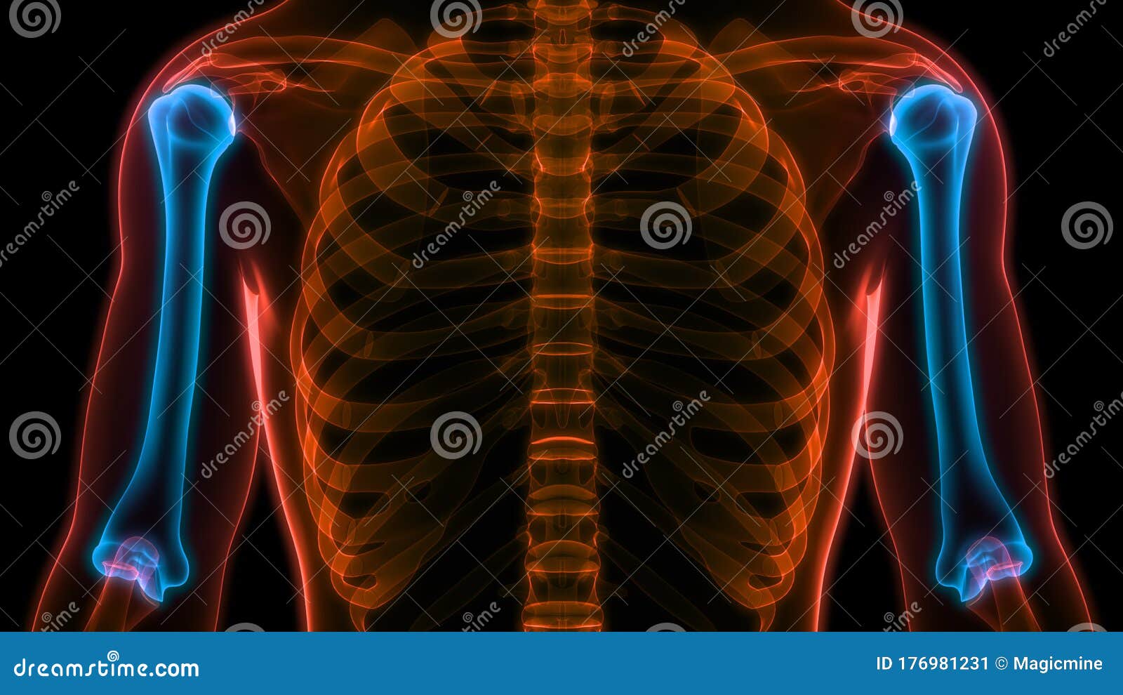 Humerus X-ray. Osteology Of The Human Skeleton, Arm Or Upper Limb Bones ...