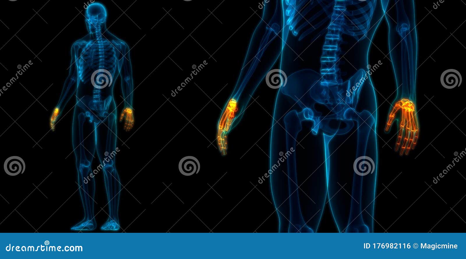Human Skeleton System Palm Hand Bone Joints Anatomy Stock Illustration ...