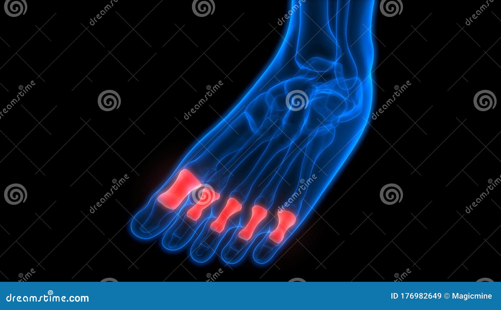 Phalanges Bones Of Human Hand Royalty-Free Stock Image | CartoonDealer ...