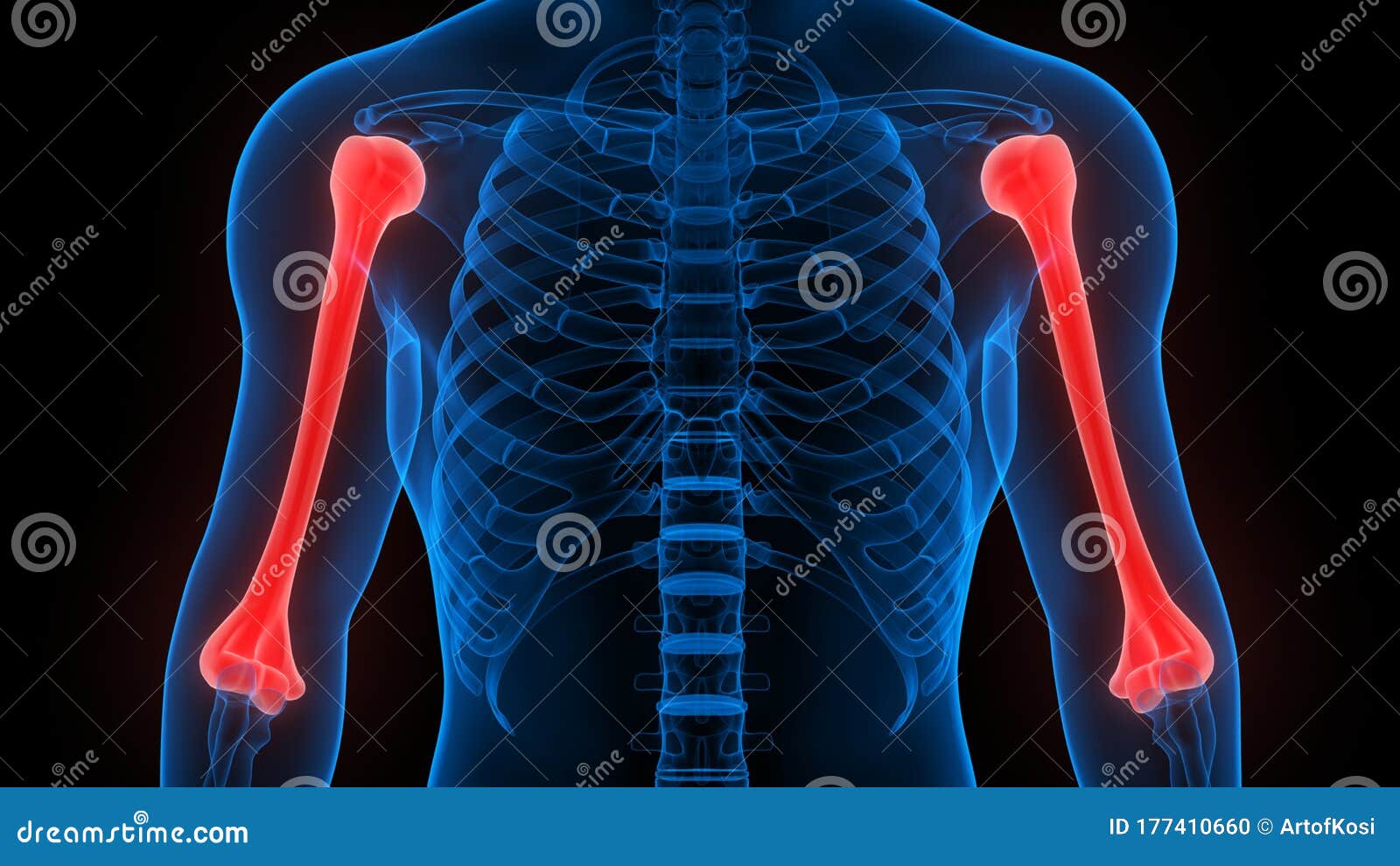 Humerus X-ray. Osteology Of The Human Skeleton, Arm Or Upper Limb Bones ...