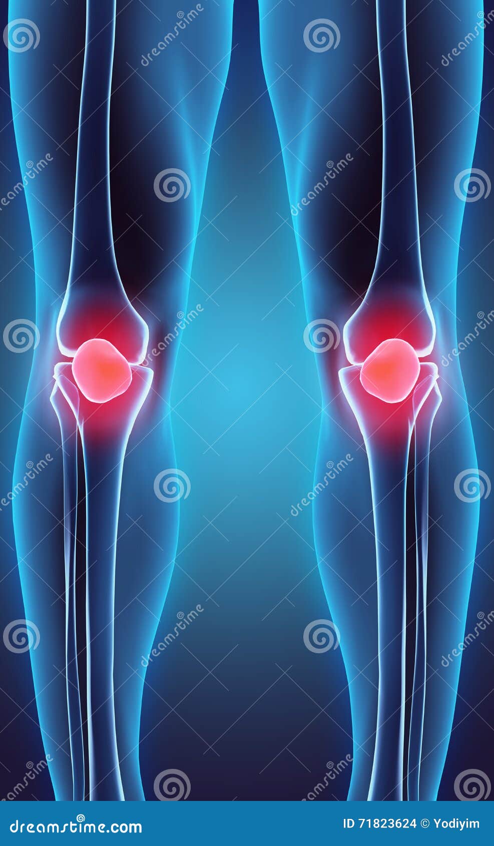 3D Illustration Der Kniescheibe, Medizinisches Konzept Stock Abbildung ...
