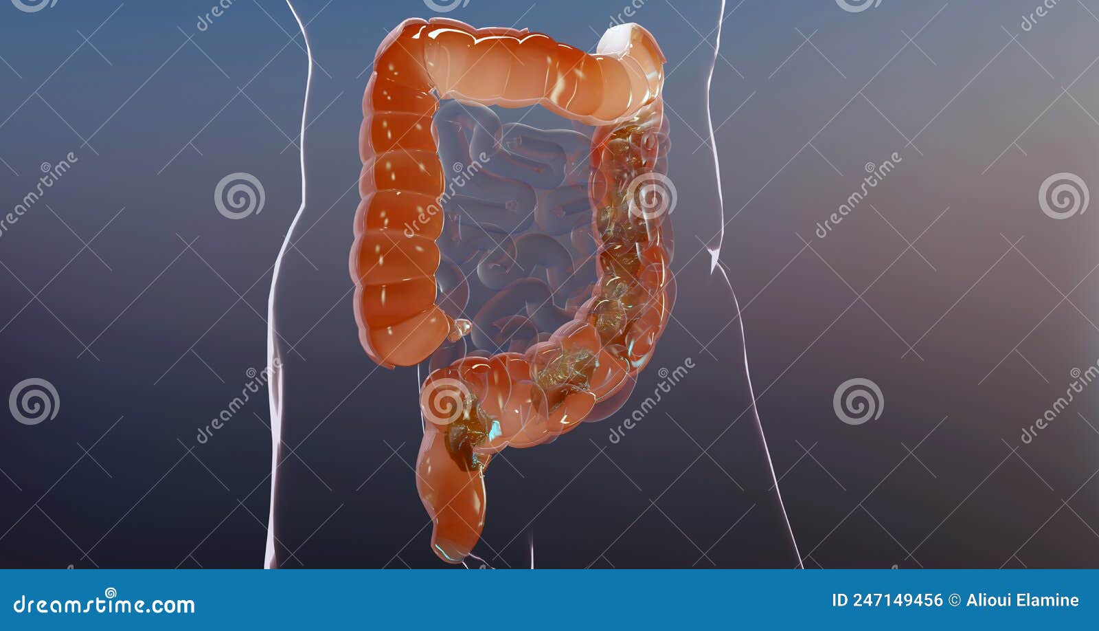 3d Illustration of Human Digestive System Anatomy, Concept of the ...