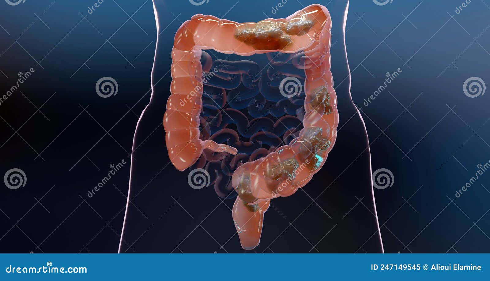 3d Illustration of Human Digestive System Anatomy, Concept of the ...