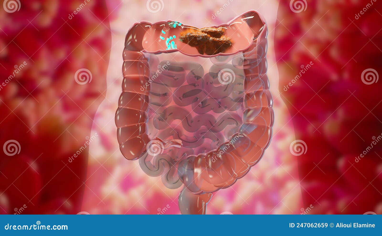 3d Illustration of Human Digestive System Anatomy, Concept of the ...