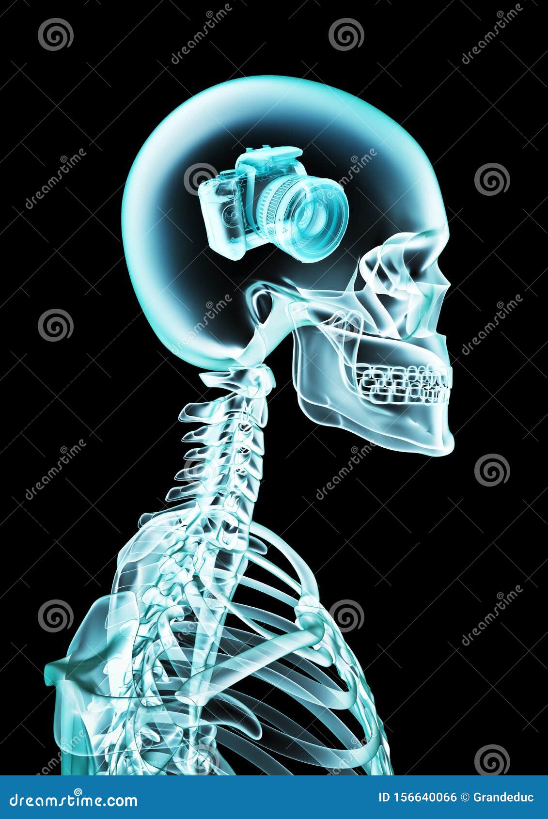 X-ray photographic memory stock illustration. Illustration of medicine ...