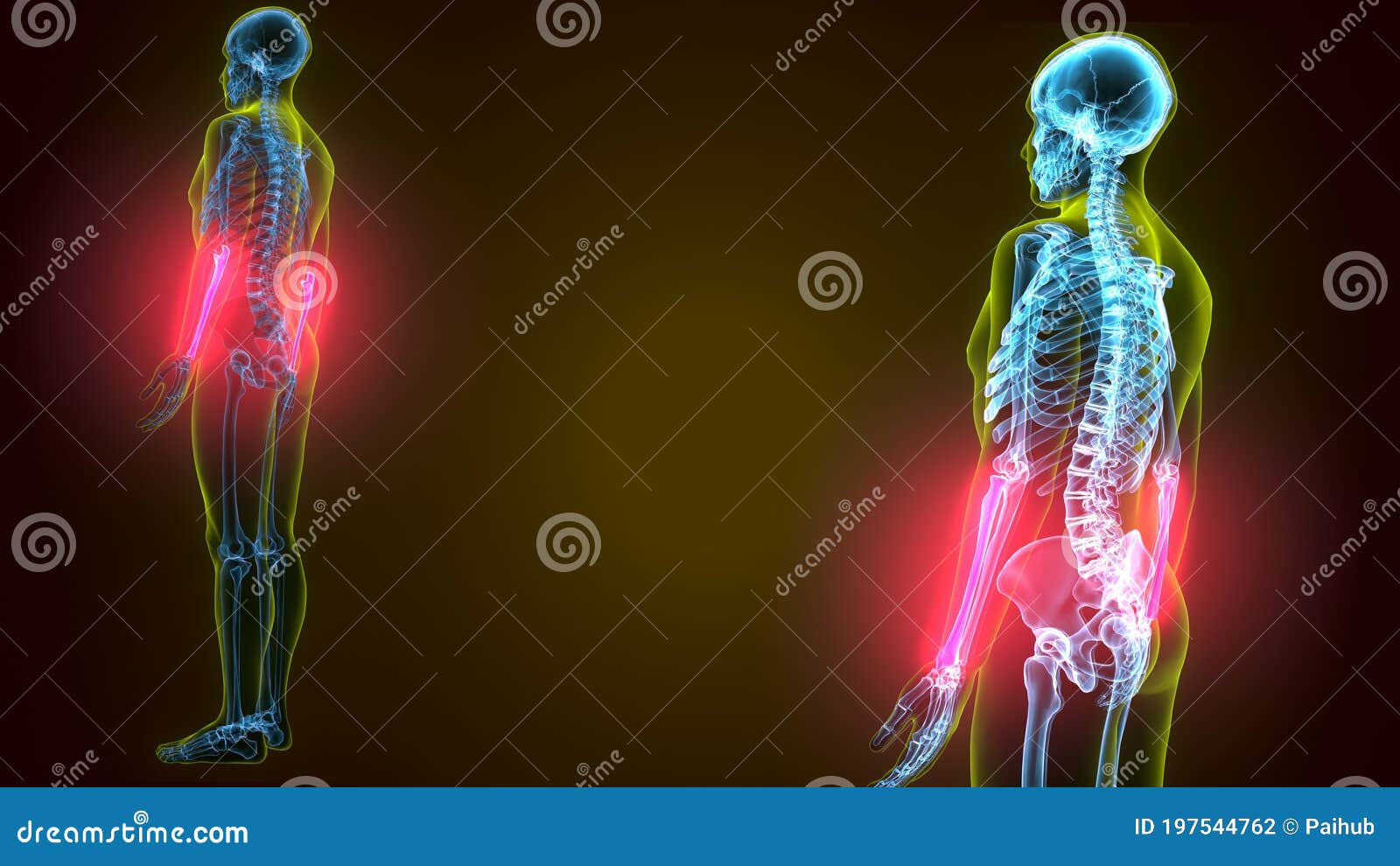 3d Illustration of Human Skeleton Ulna and Radius Bone Anatomy Stock ...