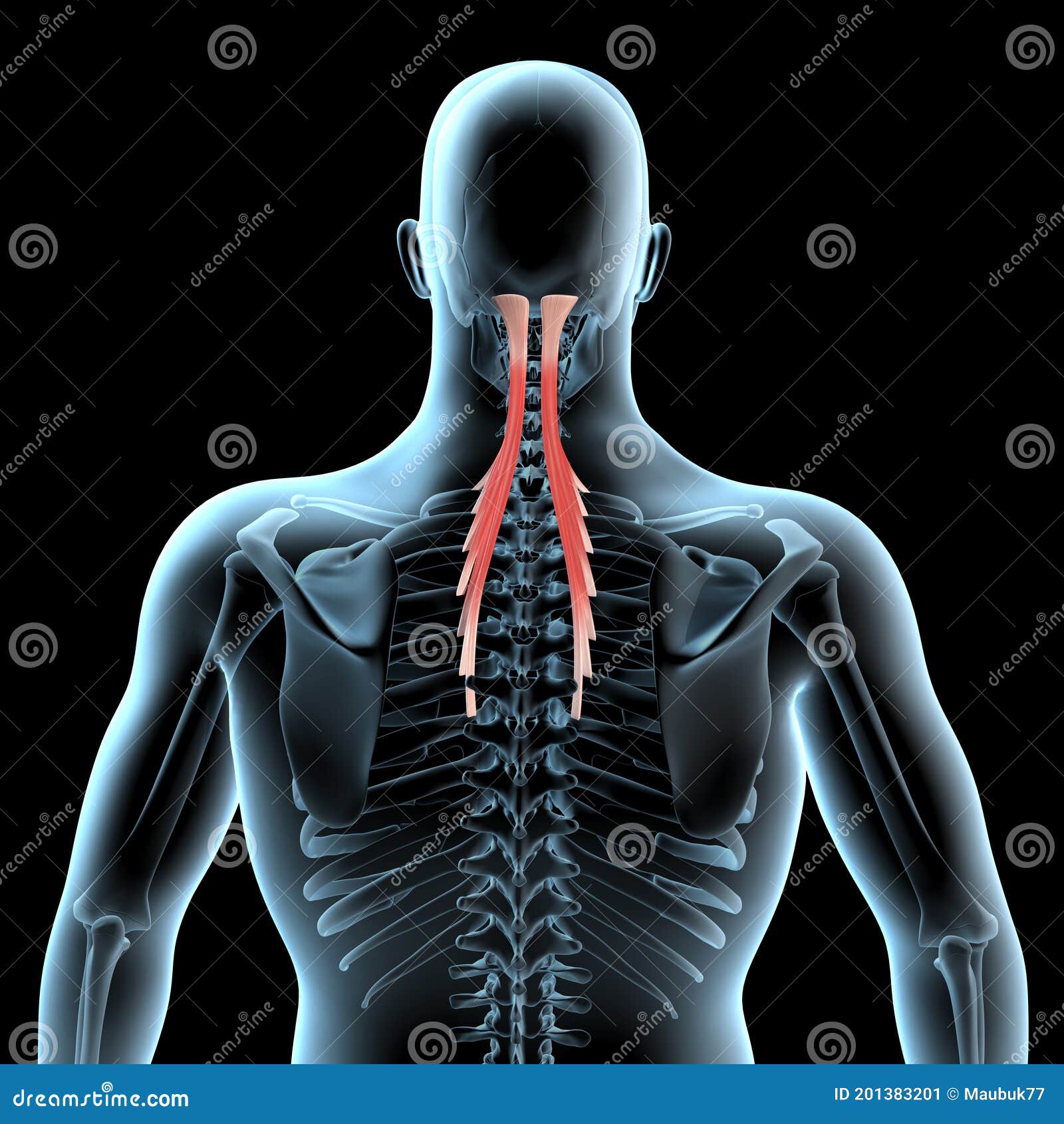 Semispinalis Muscles. Trigger Points And Referred Pain On The Back Of ...