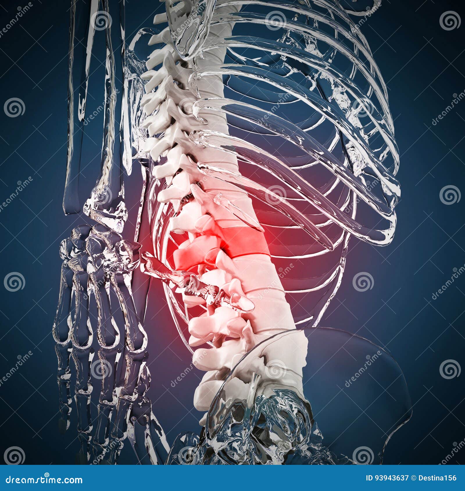 3D Illustration Showing Back Pain. 3D Illustration Stock Illustration ...