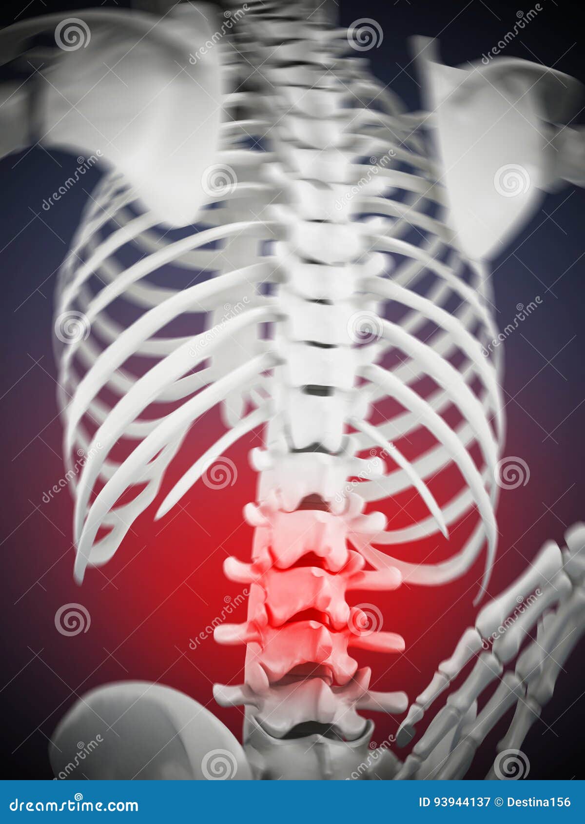 3D Illustration Showing Back Pain. 3D Illustration Stock Illustration ...