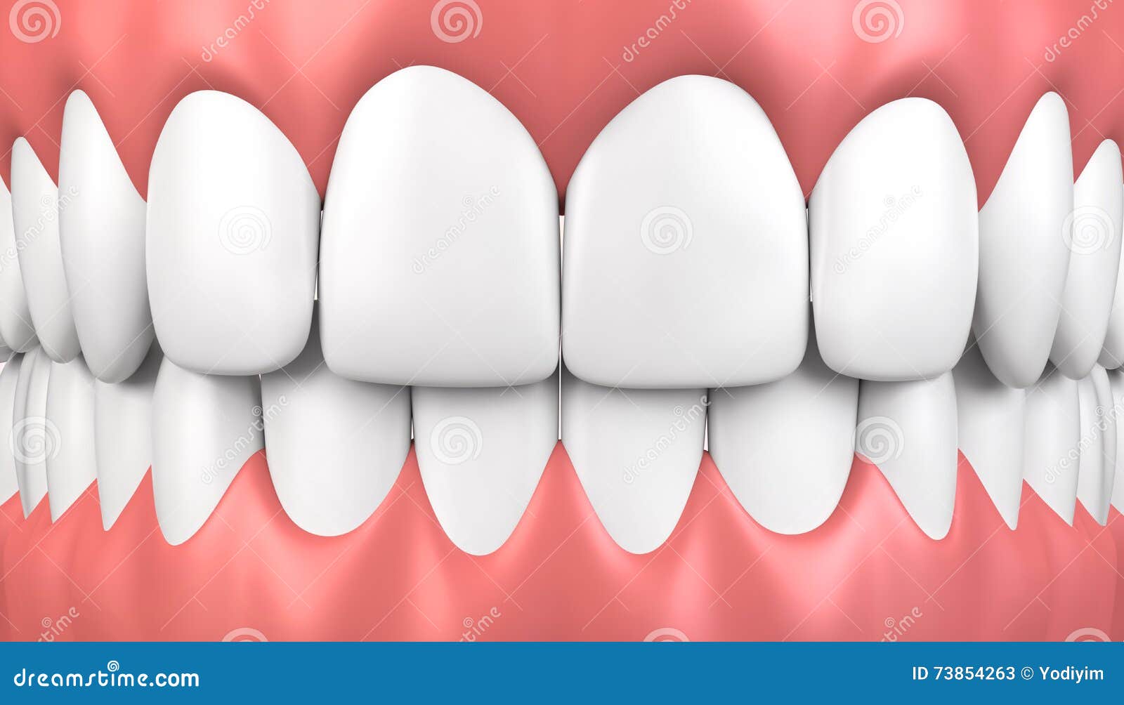 3D Illustration Teeth and Gum Model. Stock Illustration - Illustration ...