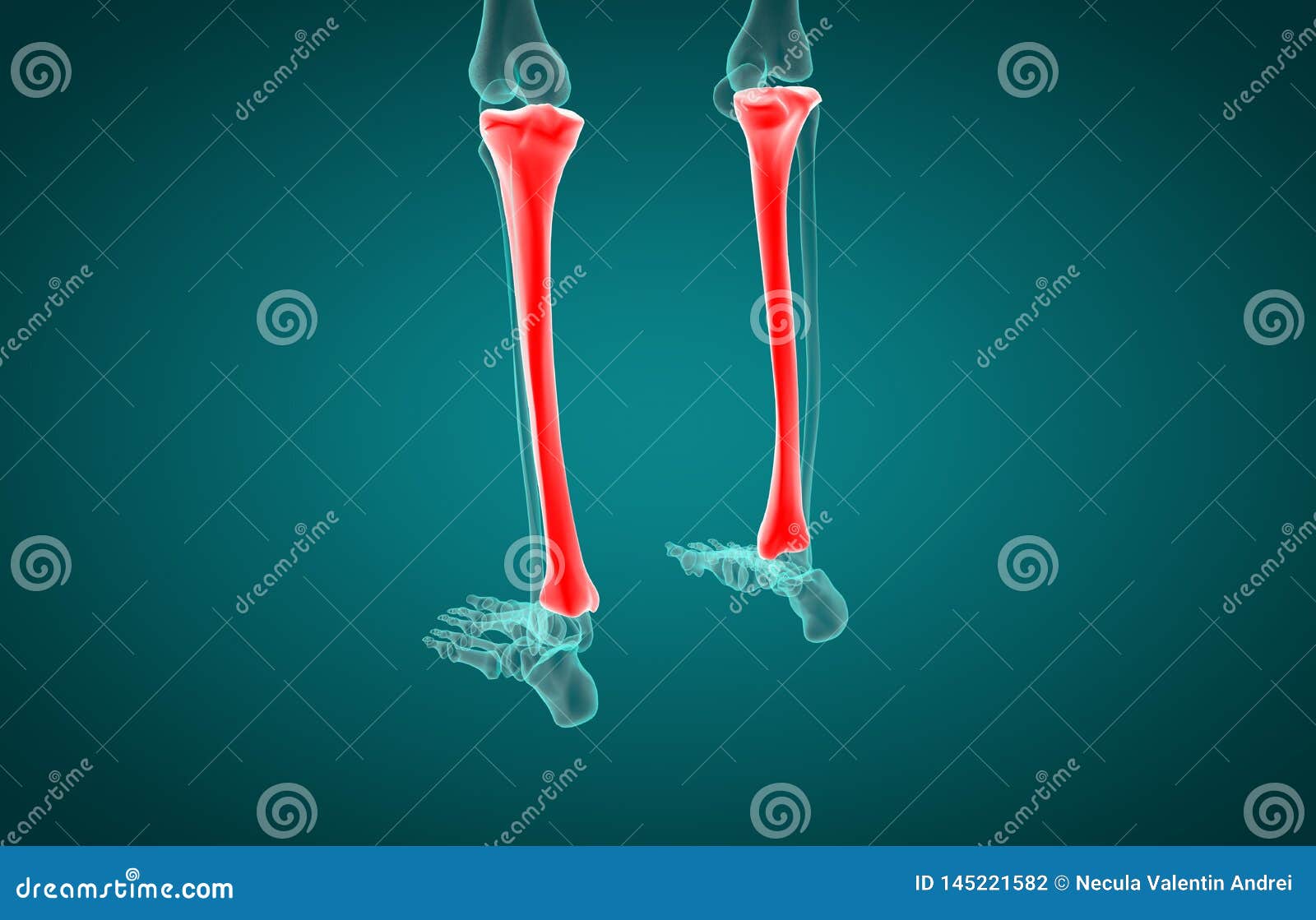 3D Illustration of Tibia, Medical Concept Stock Illustration ...