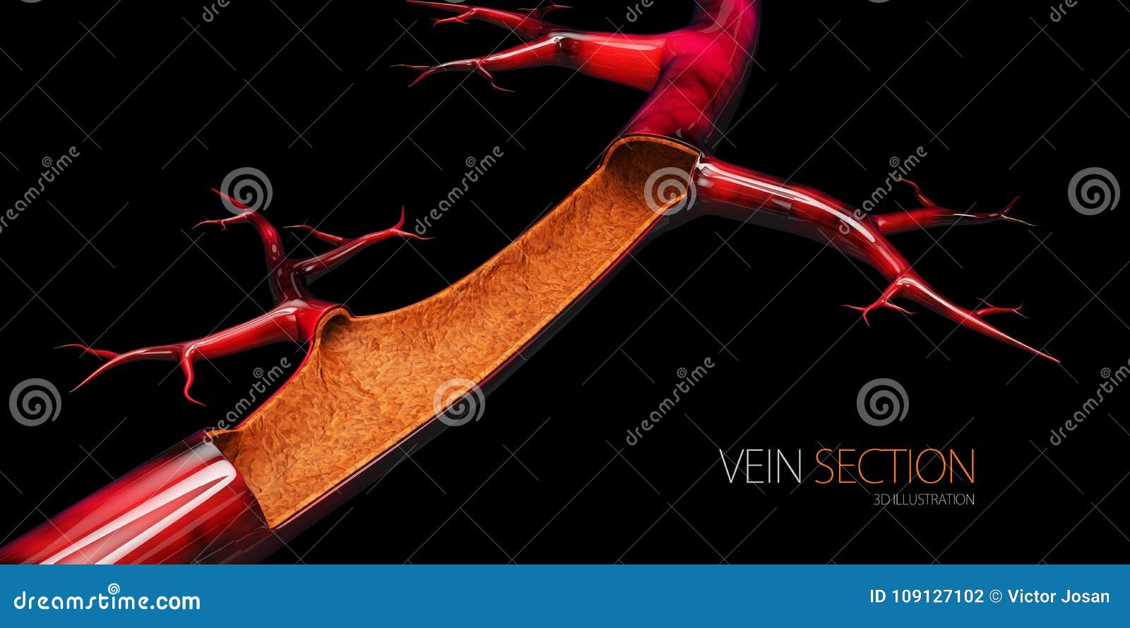 3d Illustration of Vein without Blood Cell, Isolated Black Stock ...