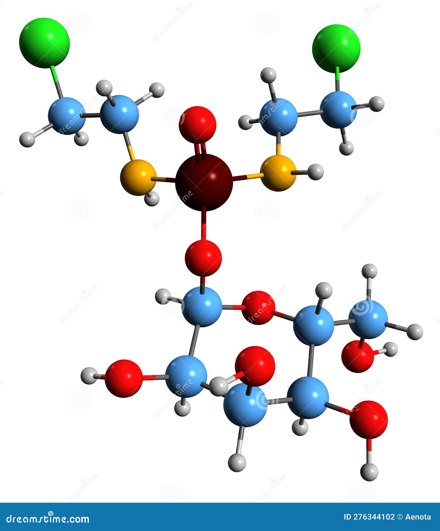 Glioblastoma Multiforme GBM Brain Cancer - Isometric View 3d ...