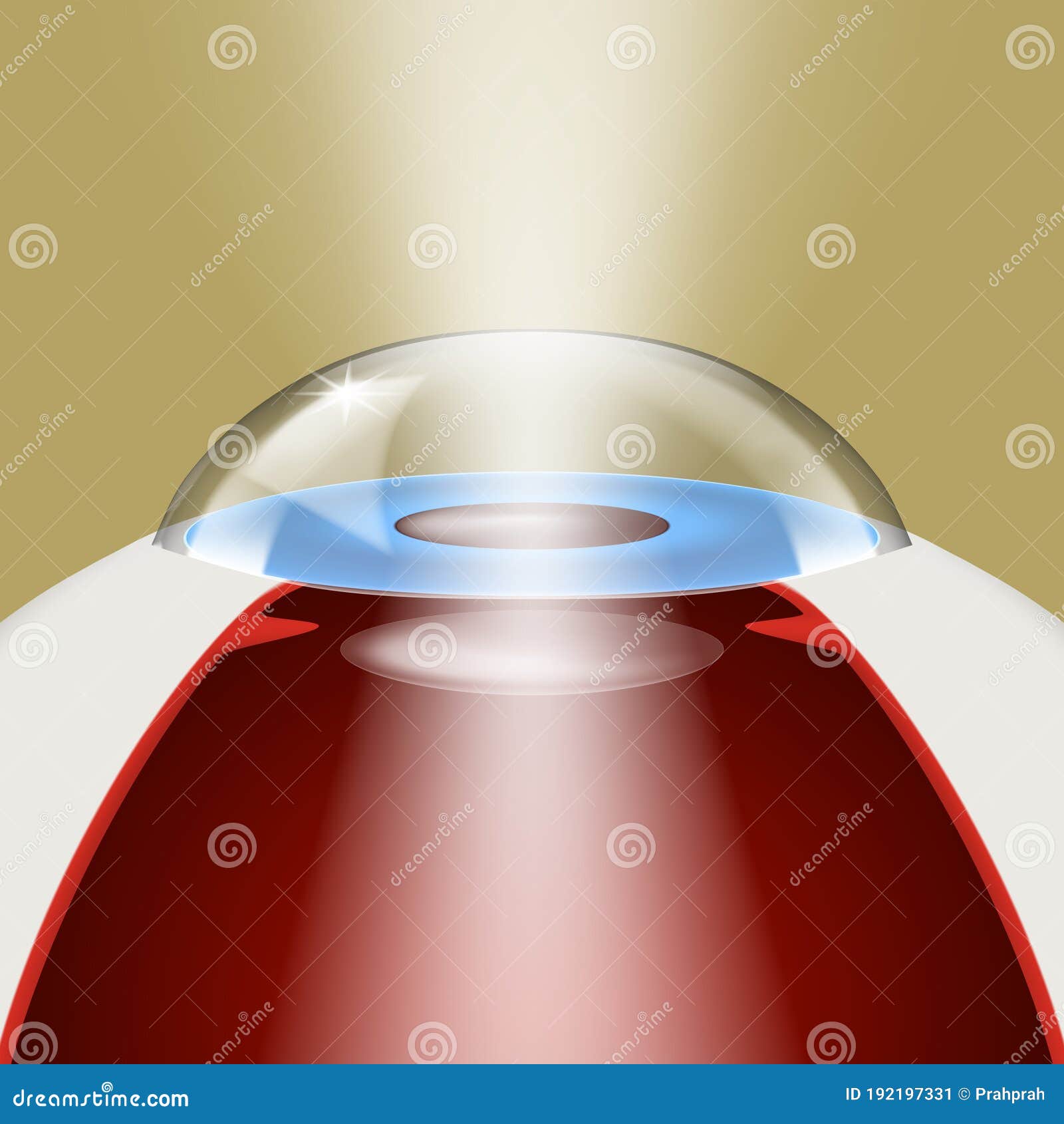 Intraocular Lenses And Eye Anatomy Vector Illustration Stock ...
