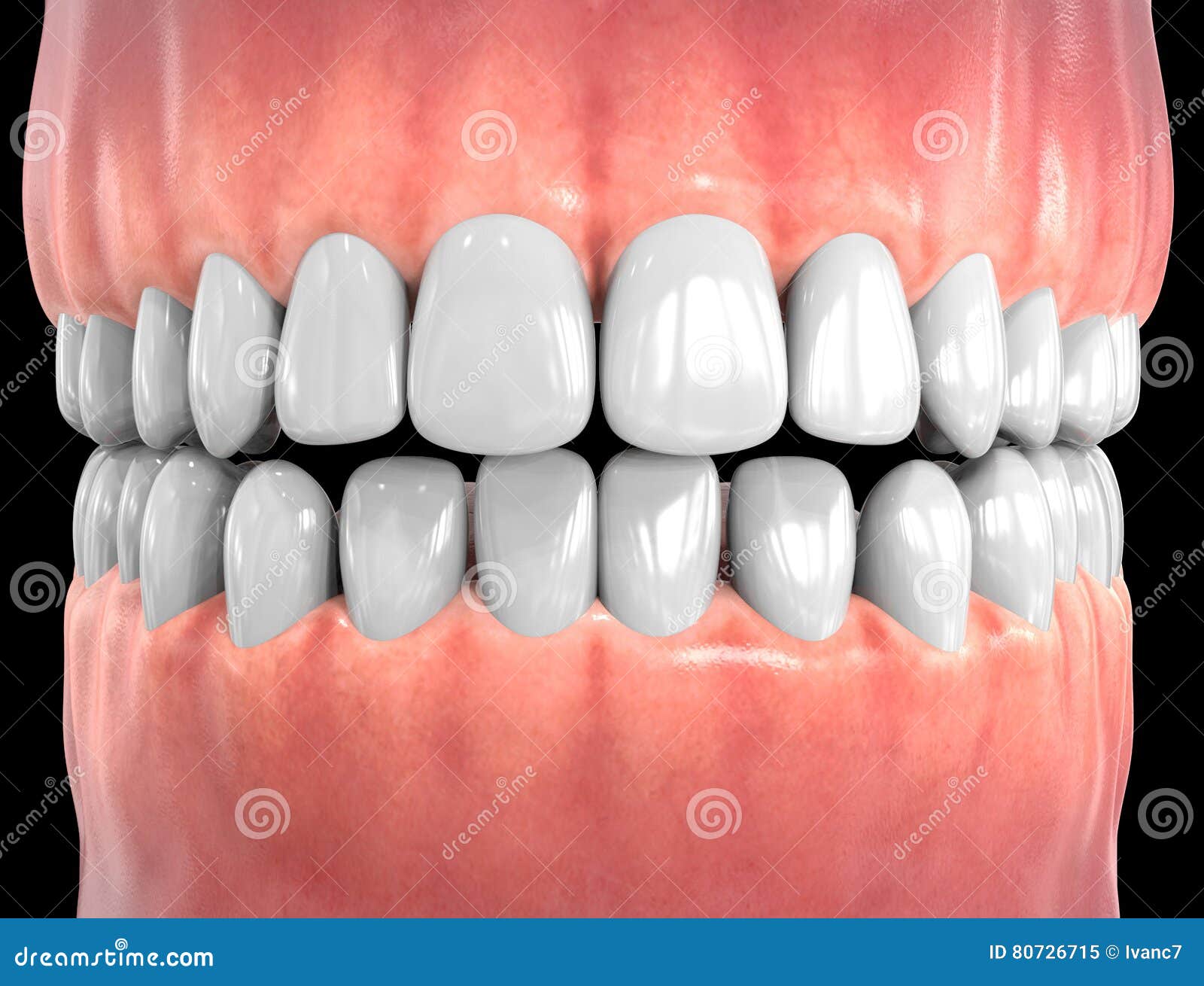 3D Isolated Teeth. stock illustration. Illustration of treatment - 80726715