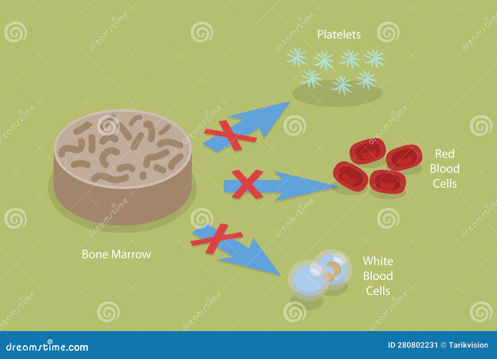 Anemia: Blood Test Samples Comparison Vector Illustration ... Anemia: Blood Test Samples Comparison Vector Illustration ...
