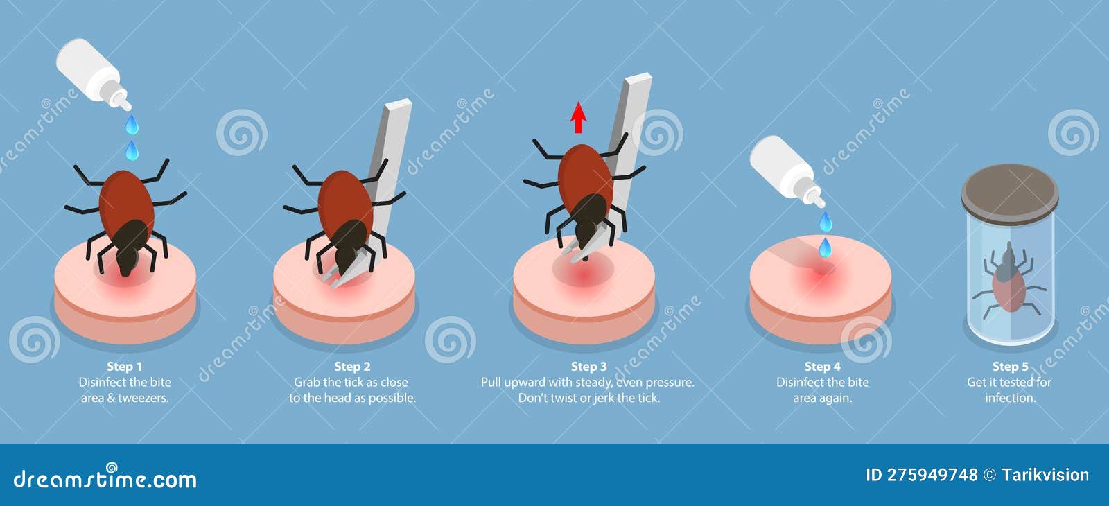 How To Remove A Tick. The Correct Way Using Forceps. 3D-rendering ...