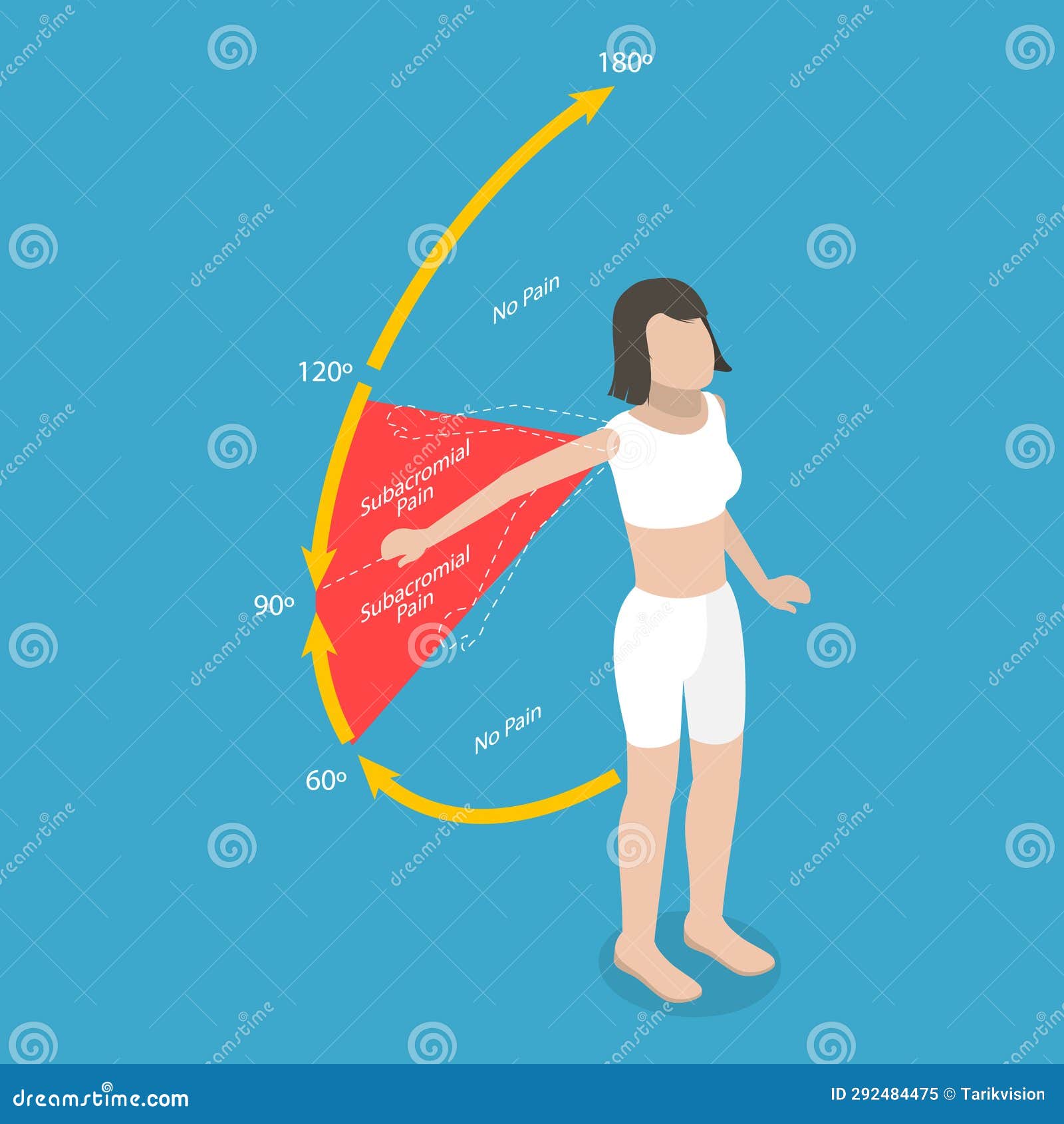 3D Isometric Flat Vector Conceptual Illustration of Painful Arc Test ...