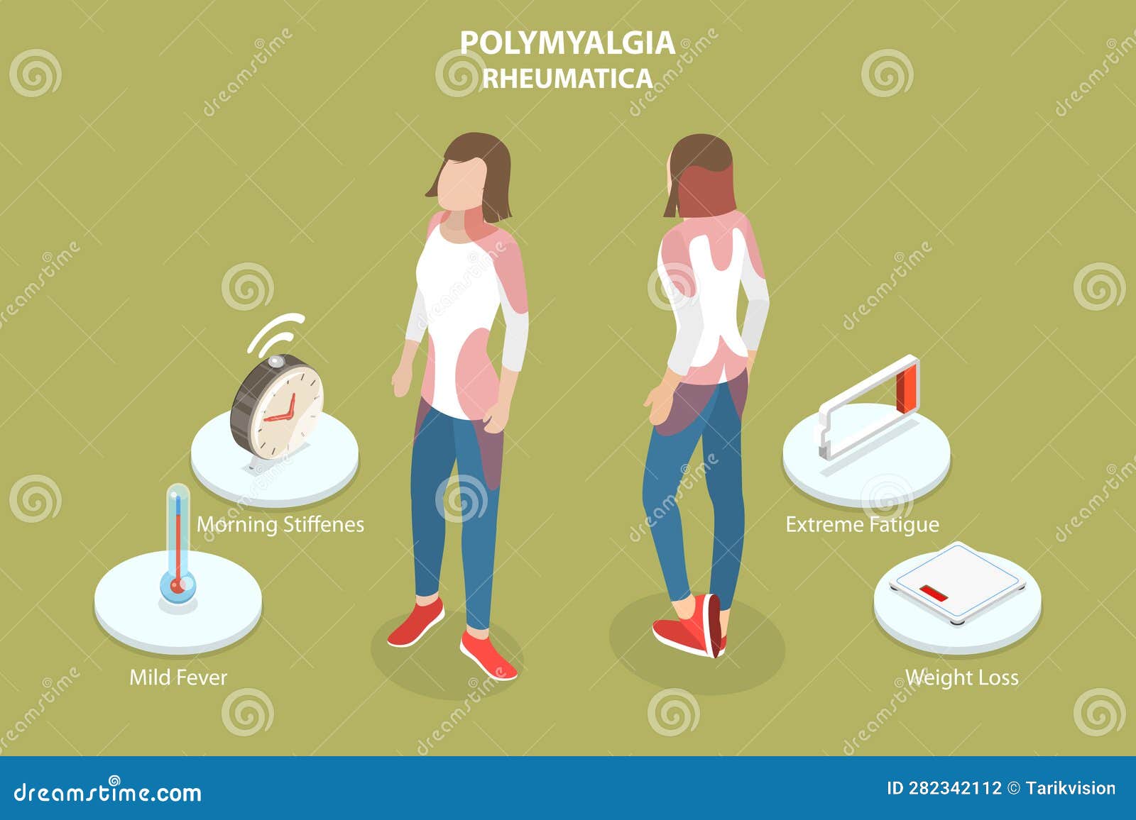 3D Isometric Flat Vector Conceptual Illustration of Polymyalgia ...