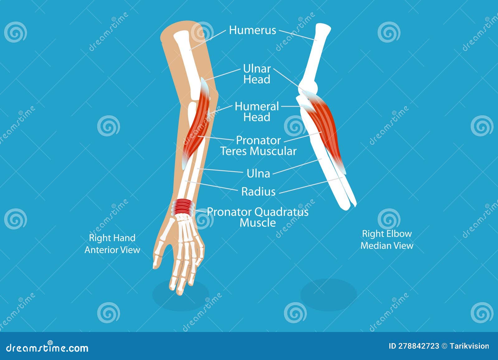 3D Isometric Flat Vector Conceptual Illustration of Pronator Teres ... 3D Isometric Flat Vector Conceptual Illustration of Pronator Teres ...