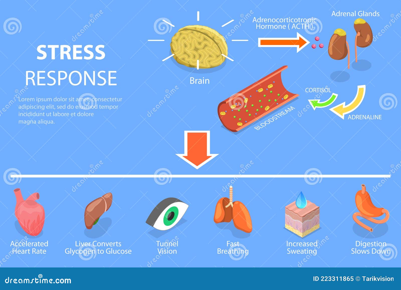 3D Isometric Flat Vector Conceptual Illustration of Stress Response ...