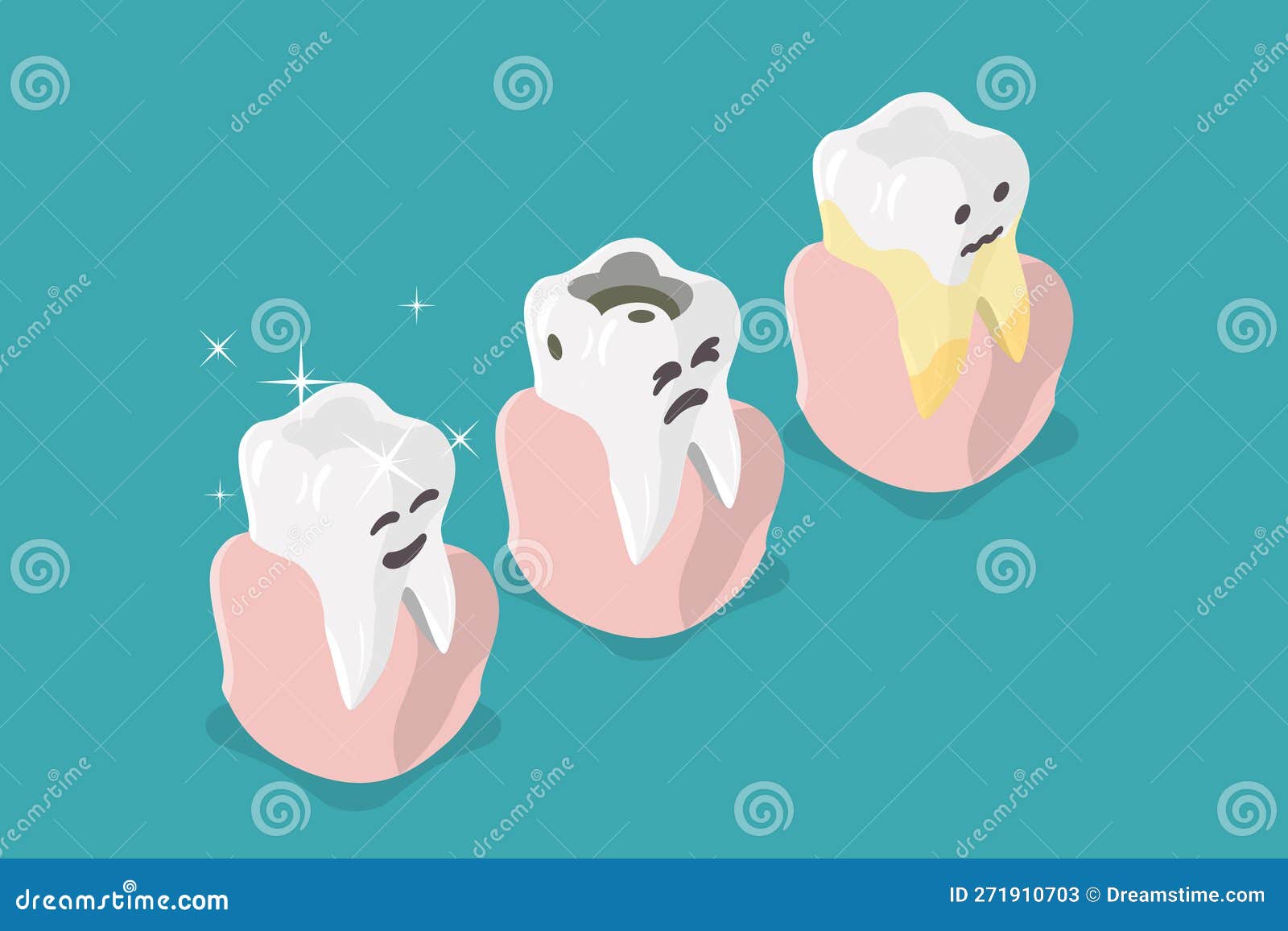 3D Isometric Flat Vector Conceptual Illustration of Tooth Decay Stock ...