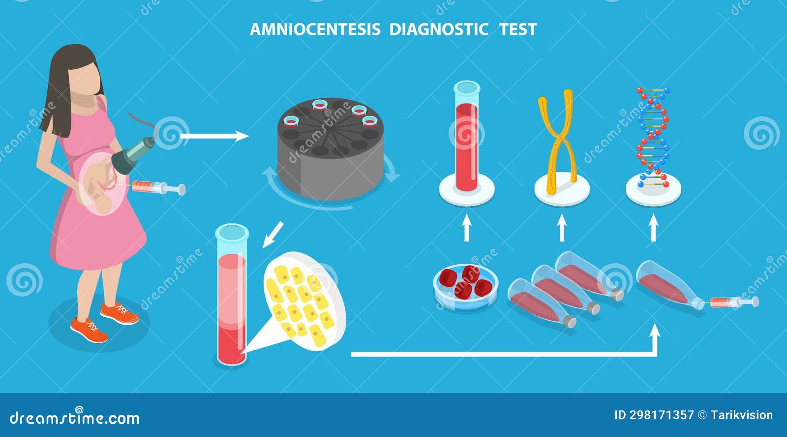3D Isometric Flat Vector Illustration of Amniocentesis Diagnostic Test ...