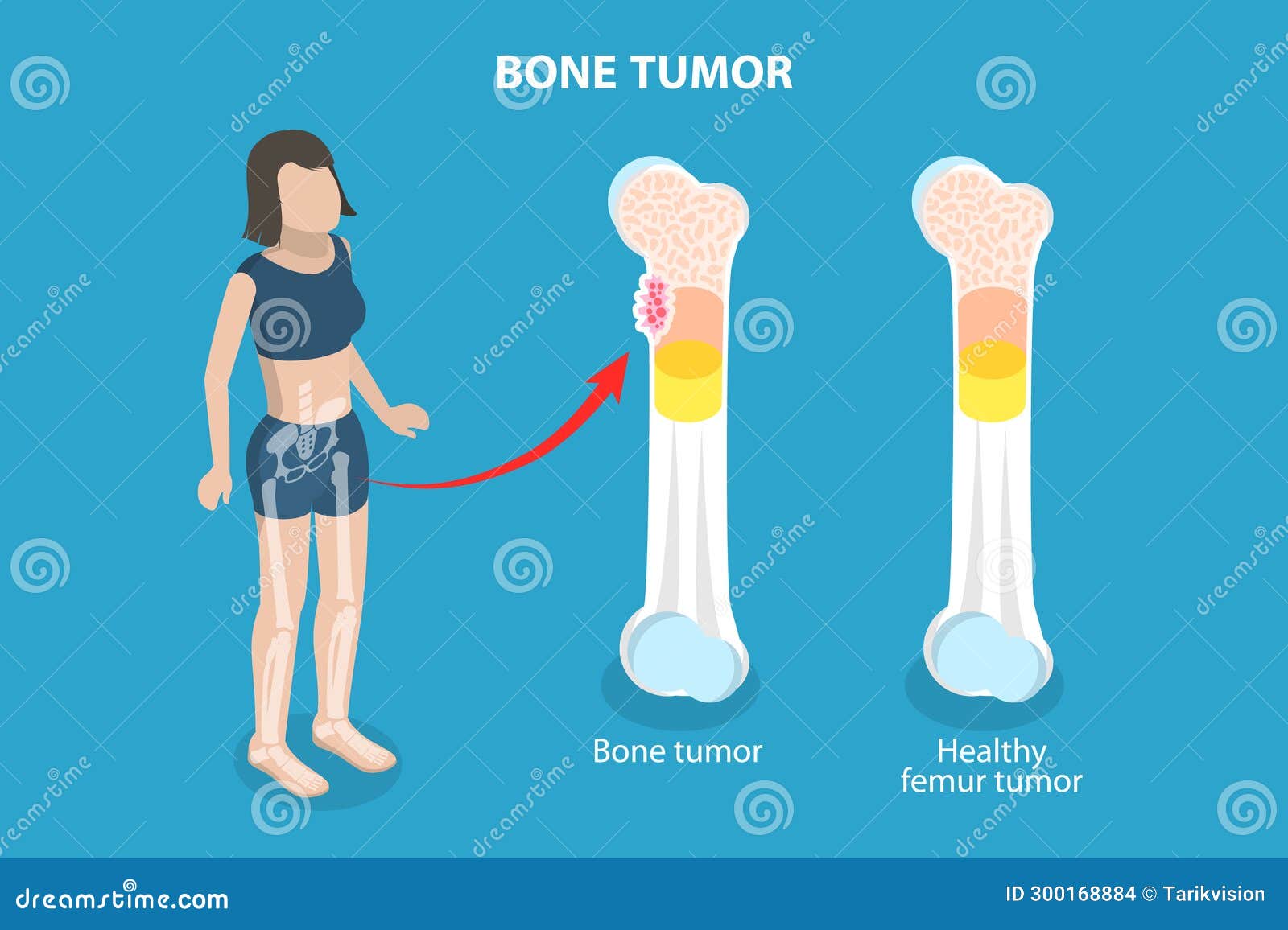 Set Isometric Bone Pain, Syringe, Eye Drop Bottle And Abdominal ...