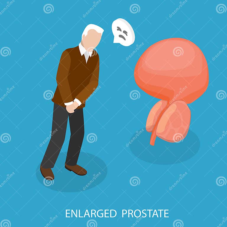 3D Isometric Flat Vector Illustration of Enlarged Prostate Stock Vector ...
