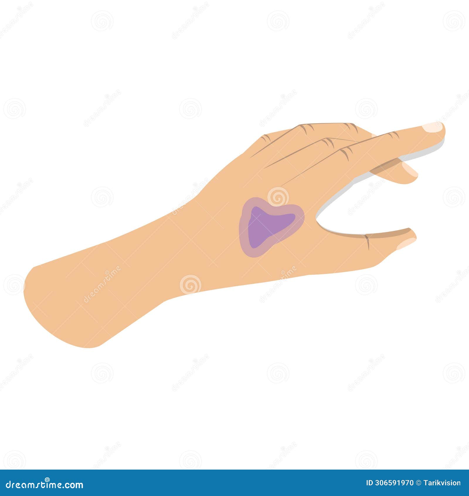 First Aid For Trauma Set, Broken Arm With Wound, Bruise Or Bleeding ...